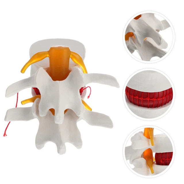 HUMAN LUMBAR DISC Model Spiral Bone Model Vertebral Column Model £21.99 ...