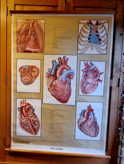 LARGE VINTAGE ADAM Rouilly Anatomical Poster Chart The Normal Heart £ ...