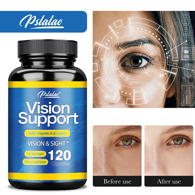 VISION SUPPORT - Vitamin A,Lutein -Reduce Eye Fatigue and Improve ...