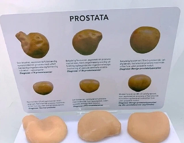 MALE PROSTATE MODEL Genital Anatomy Male Pelvic Sagittal Section ...