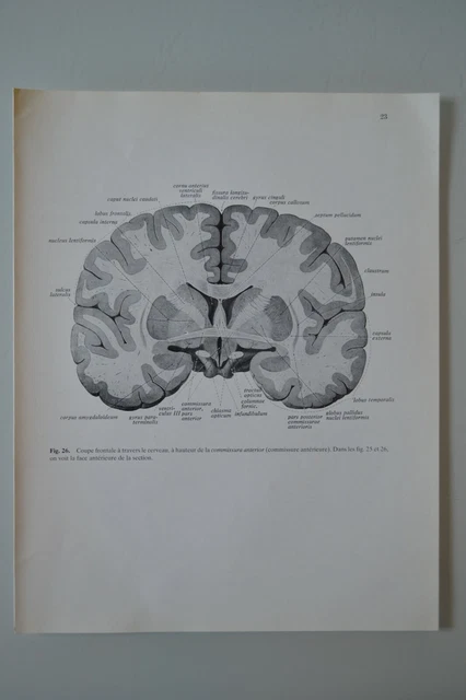HUMAN ANATOMY BOARD NERVOUS SYSTEM BRAIN ATLAS Dr SOBOTTA MEDICINE £10. ...