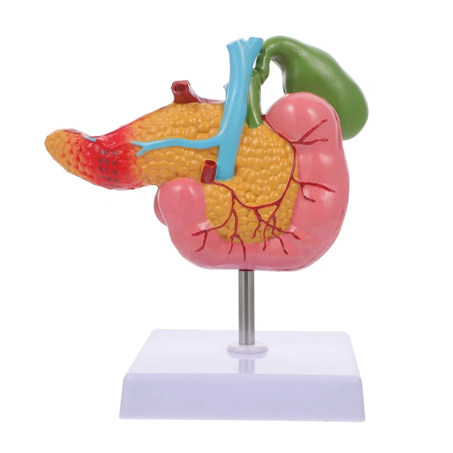 HUMAN PANCREAS MODEL Gallstone System Gallbladder $41.29 - PicClick