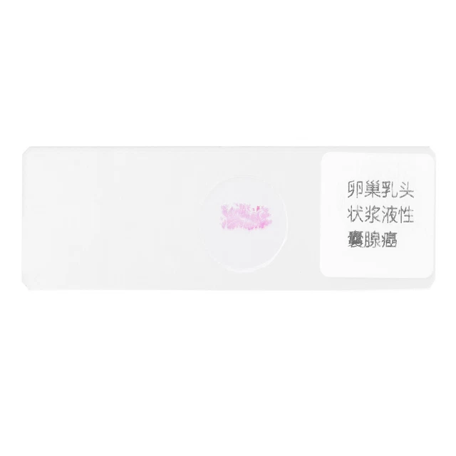 MICROMETER PATHOLOGY SECTION Microscope Slides for Analysis Specimen £ ...