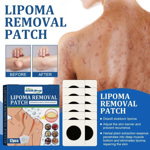 FOR BODY LIPOMA Removal Patch Lipoma Lumps Removal Patches Lymphatic ...