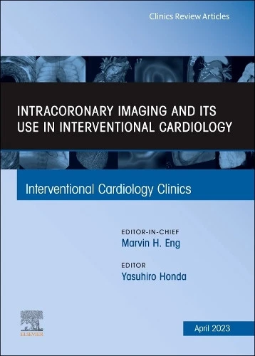 YASUHIRO HONDA Intracoronary Imaging and its use in Interventional Card ...