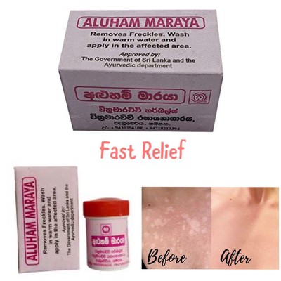 HERBAL ANTIFUNGAL Relief Cream Tinea Versicolor Pityriasis Versicolor ...