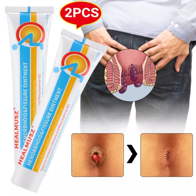 2~haemorrhoids Treatment Cream Hemorrhoid Piles Anal Fissure Prolapse