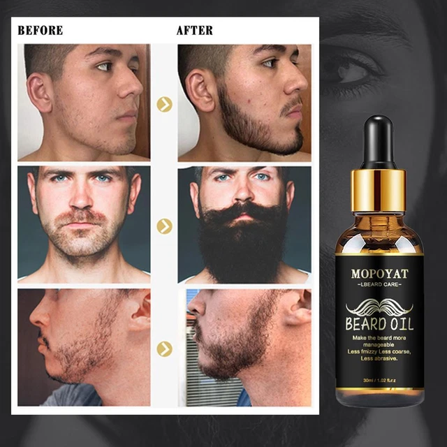 BEARD GROWTH OIL Serum Fast Growing hair Mustache Facial Grooming For ...