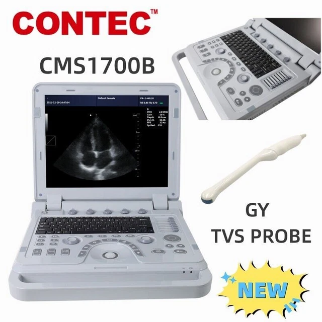 OB COLOR DOPPLER ultrasound Biopsy Guide in-vitro fertilization TVS ...