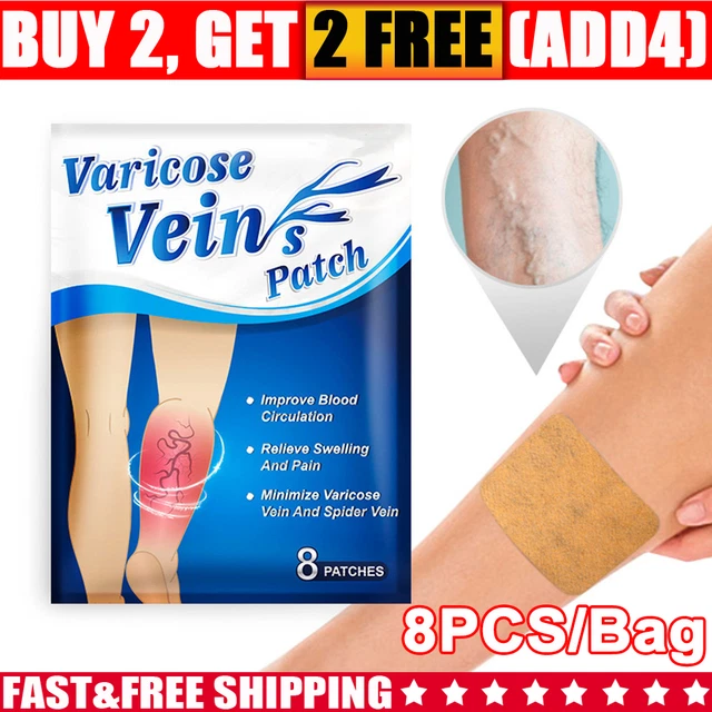 VARICOSE VEINS PLASTER Patch Pad Vasculitis Phlebitis Spider Patch Leg ...