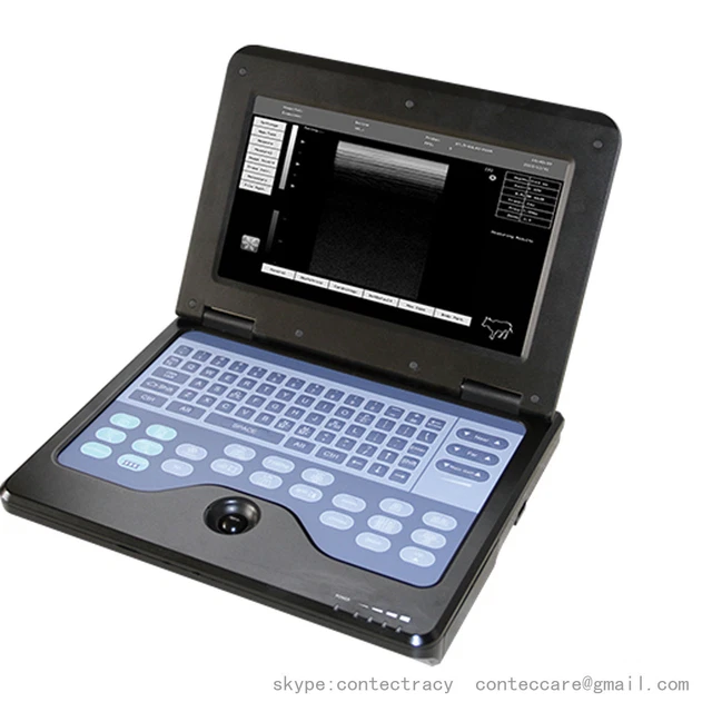 ESCÁNER DE ULTRASONIDO CONTEC CMS600P2 máquina de diagnóstico portátil ...