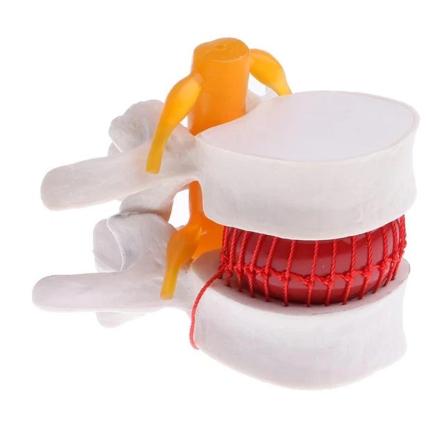 ANATOMICAL DISC MODEL for Human Lumbar Vertebrae | Laboratory £20.70 ...