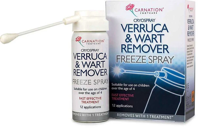 Carnation Cryospray Verruca And Wart Remover Freeze Spray FOR SALE ...