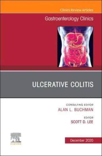 ULCERATIVE COLITIS, AN Issue of Gastroenterology Clinics of North A ...