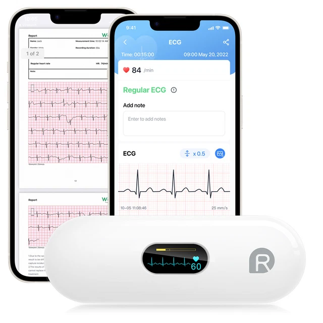 PORTABLE ECG EKG Monitor with Bluetooth Connectivity Heart Rate Monitor ...
