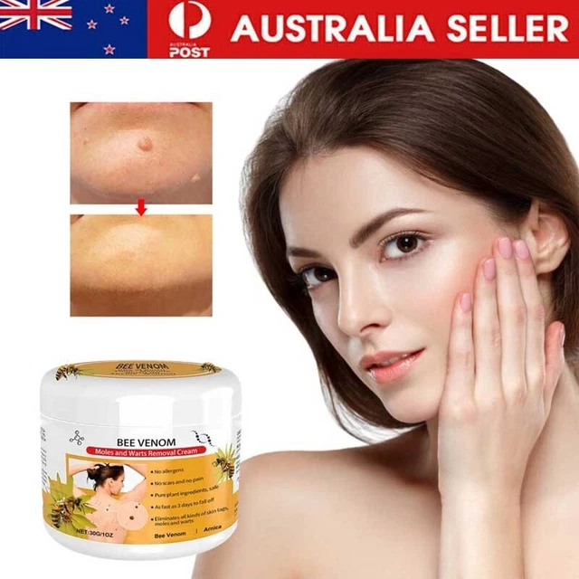 LENARO BEE-VENOM WART and Tag Remover Bee-Venom Mole & Wart Treatment-Cream $11.49 - PicClick AU