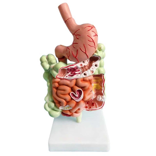 MODELL DES MENSCHLICHEN Verdauungssystems Magenanatomie Dickdarm ...
