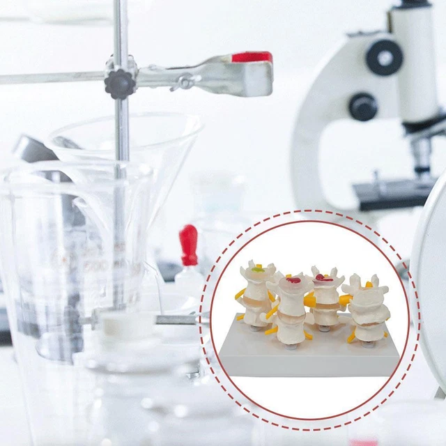 Spinal Disc Human Spine Model 4-Stage Diseased Lumbar Spine Comparison ...