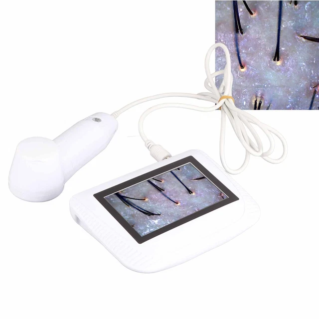 DIGITAL SCALP HAIR Microscope Skin Detector Analyzer Skin Care 50X 200X ...