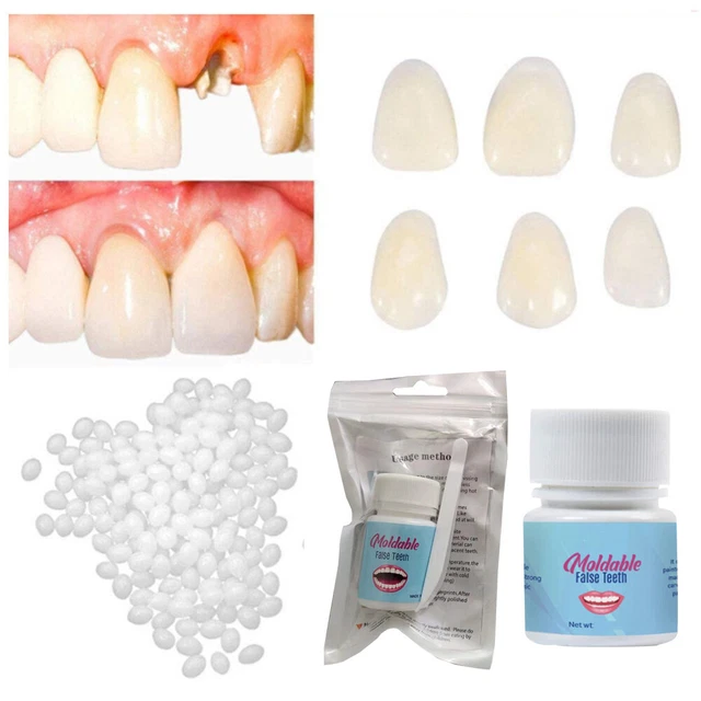 TEMPORARY TOOTH REPAIR Kit Resin Fix Broken False Teeth Fill Gaps ...