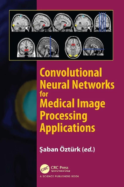 Convolutional Neural Networks For Medical Image Processing Applications By Saban 257 88