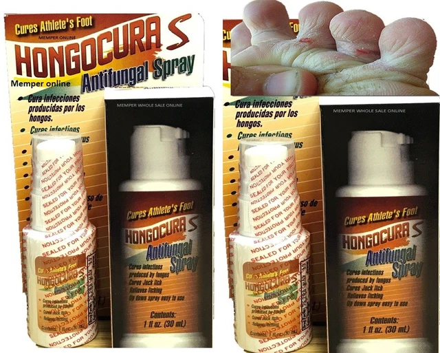 Anti Fungal Treatment Extra Strength Toenail Fungus Athletes Foot Fungi 9030