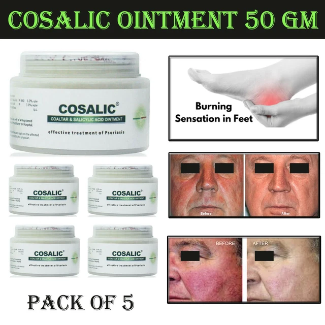 COAL TAR & Salicylic Acid Ointment Cosalic For Psoriasis 50g + Free ...