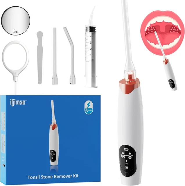 Ercp Stone Extraction