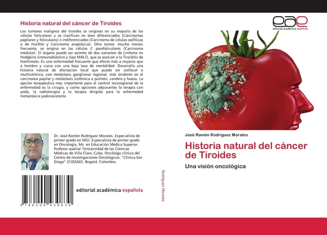 HISTORIA NATURAL DEL cáncer de Tiroides Una visión oncológica Morales Buch 2020 EUR 55,90 ...
