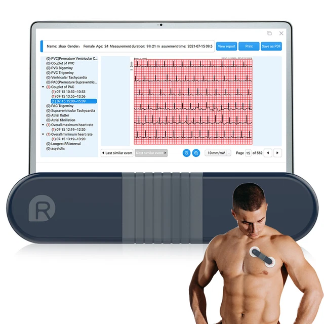 LONG-TERM ECG MONITOR 24-hour pulse belt ECG device data evaluation via ...