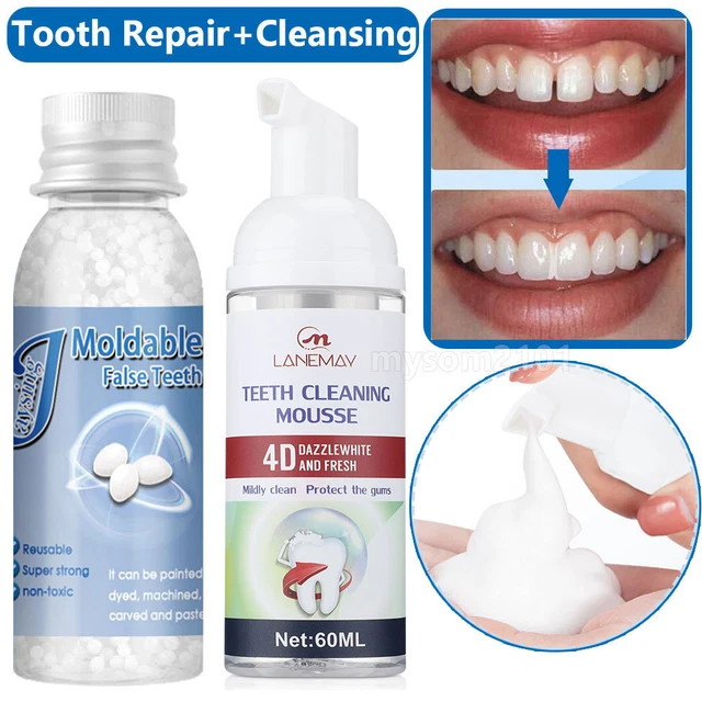 TOOTH REPAIR GRANULES /Teeth Mousse Stain Removal Reusable Temporary ...