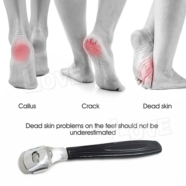 FOOT FILE PEDICURE Callus Rasp Hard Skin Shaver Remover Corn Cutter +20 ...