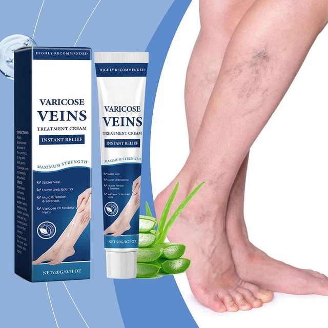VARICOSE'VEINS TREATMENT CREAM Vasculitis Phlebitis Removal Plaster ...