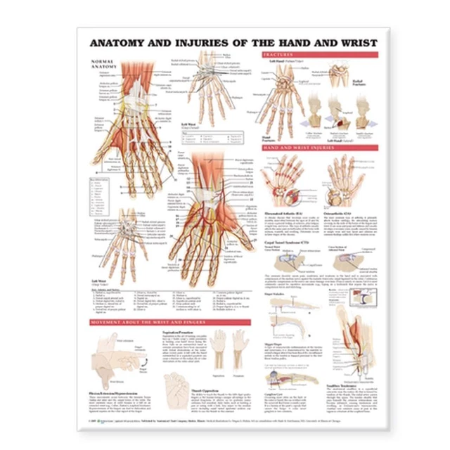 ANATOMY AND INJURIES of the Hand and Wrist Anatomical Chart - Paper ...