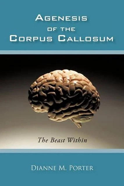 AGENESIS OF THE Corpus Callosum: The Beast Within by Dianne M. Porter ...