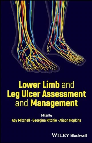 LOWER LIMB AND Leg Ulcer Assessment and Management - Paperback NEW ...