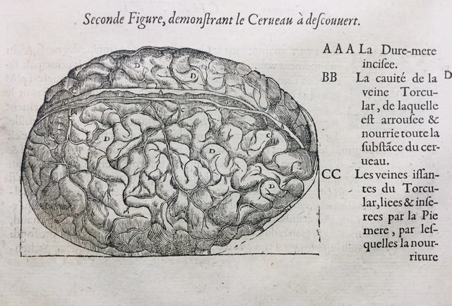 CIRUGÍA CEREBRO 1585 Cerebro Neurología Anatomía Raro Grabado En Madera ...