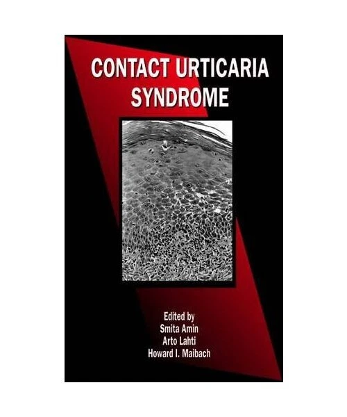 CONTACT URTICARIA SYNDROME EUR 30,15 - PicClick FR