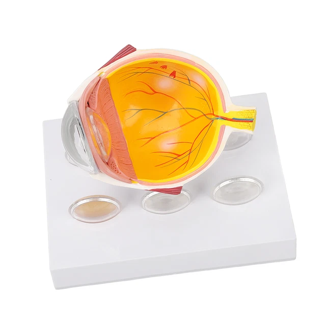 Optic Nerve