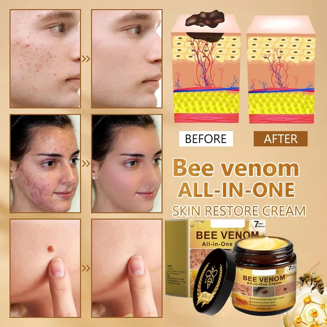 BEE VENOM ALL-IN-ONE Cream Skin Treatment 2025 Professional Bee Venom ...
