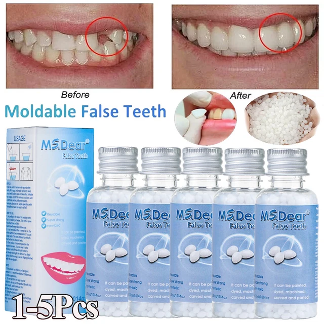 PERMANENT TEETH TOOTH Repair Strong Dental Cement Cavity Filling Kit ...