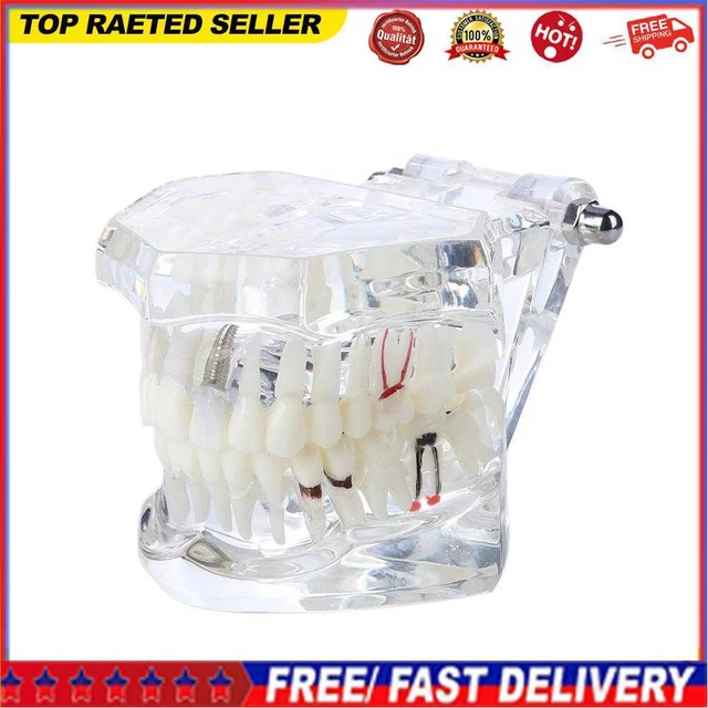 PVC TOOTH IMPLANT Model Occlusal Small Dental Model Useful Medical ...