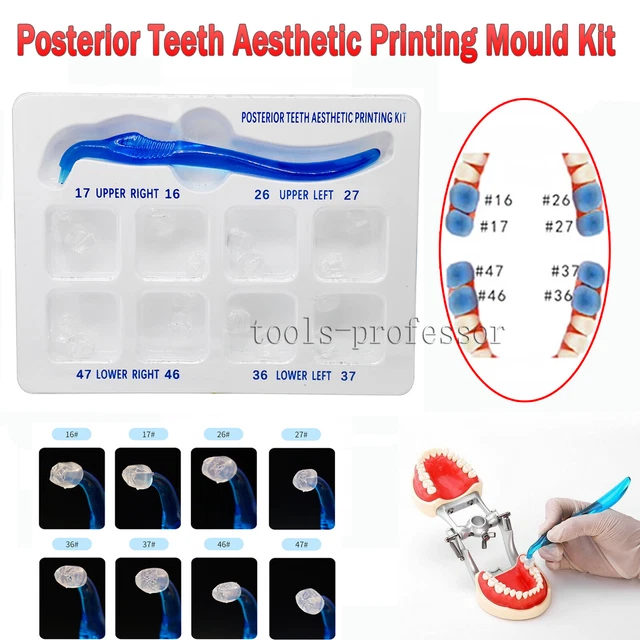 DENTAL POSTERIOR TEETH Aesthetic Printing Mould Kit Restoration Filling ...