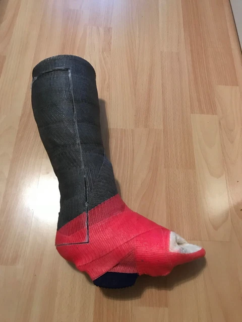 GEHGIPS GIPSBEIN - SLWC mit Gehstollen & Zehenplatte TOP CAST ...