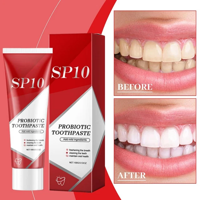 SP10 PROBIOTICS WHITENING Toothpaste Brightening Stain Removing F8E6 ...