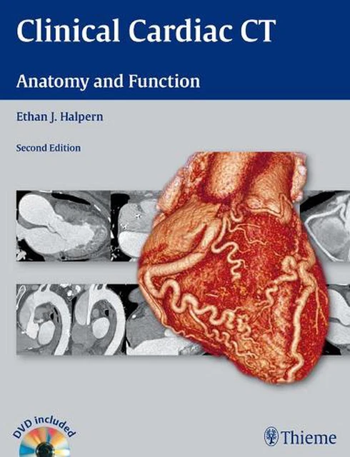 CLINICAL CARDIAC CT: Anatomy and Function by Ethan J. Halpern (English ...