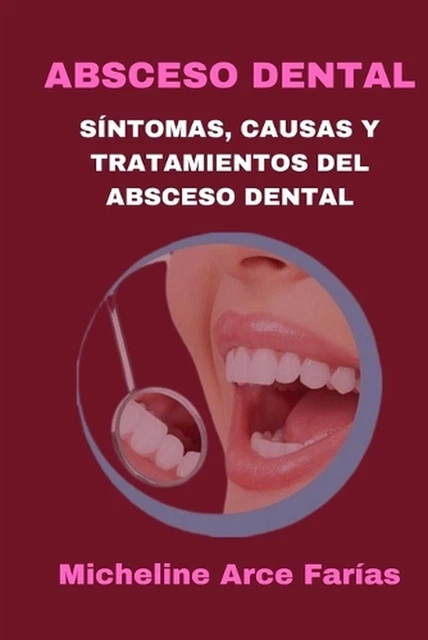 ABSCESO DENTAL: S?NTOMAS, Causas Y Tratamientos del Absceso Dental by ...