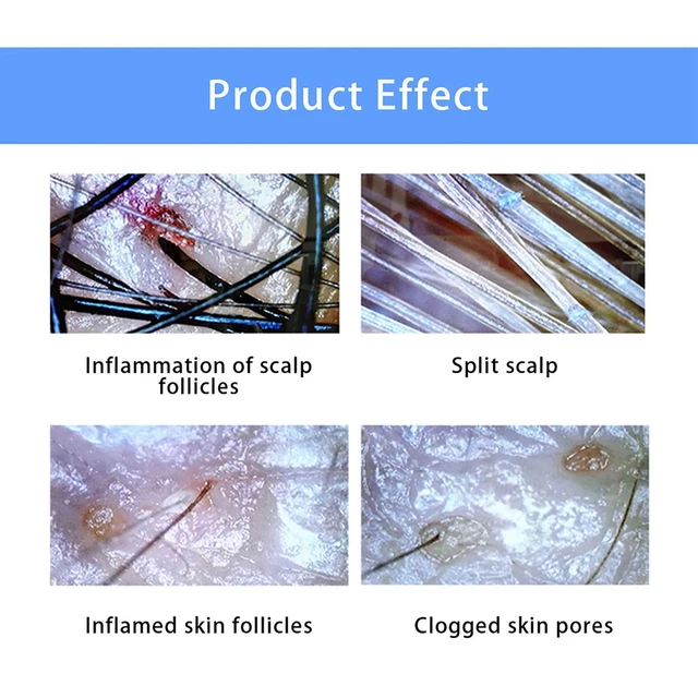 (EU PLUG)10.1INCH CHARGING Type Scalp Hair Follicle Skin Hair Detector ...