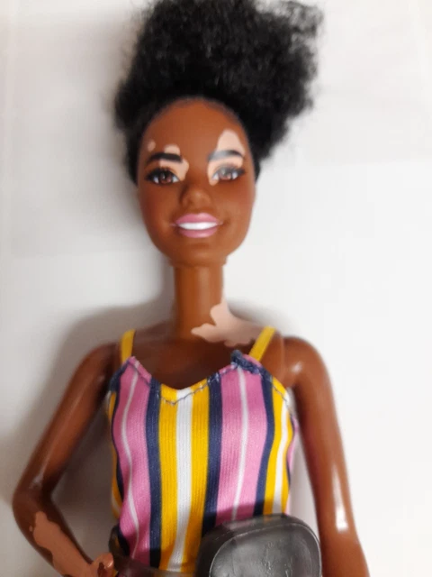BARBIE FASHIONISTAS DOLL #135 with Vitiligo wearing Striped Dress g10 ...
