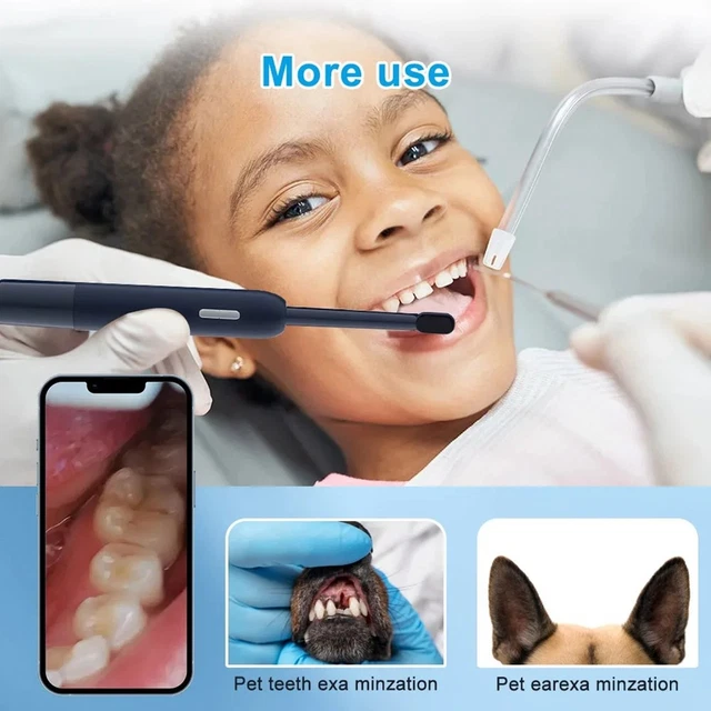 VISUAL ENDOSCOPE VISUAL Intraoral Camera 1920P for IOS/Type-C/Tablet ...